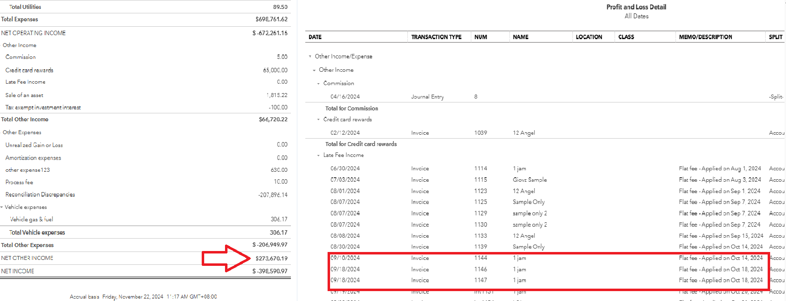 Why do my "Other Expenses" show up as negative "NET OTHER INCOME"?